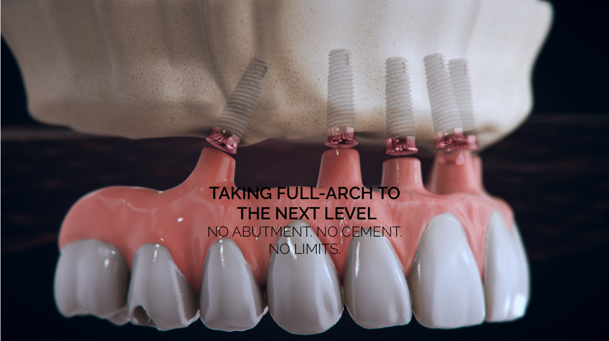 matrix® full-arch solution for your dental clinic